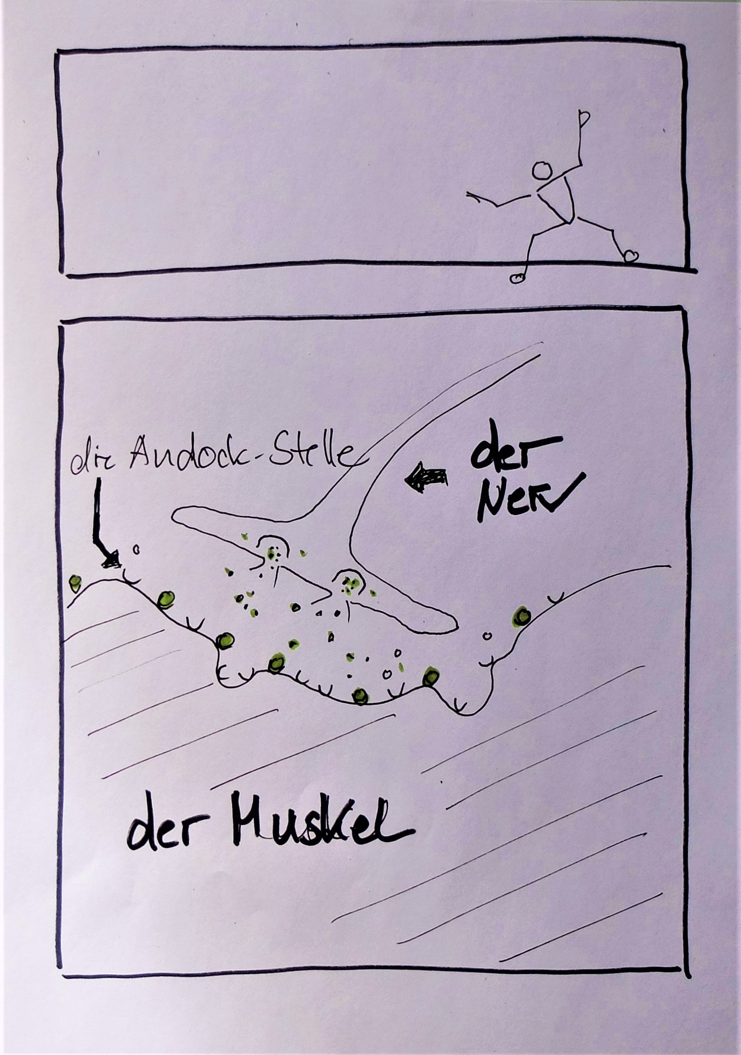 Myasthenia gravis – ein Begleiter » Myasthenia gravis, an Hand von 2 ...